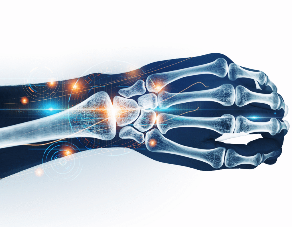 Adipose Therapy for Wrist OA (osteoarthritis): Evidence Summary